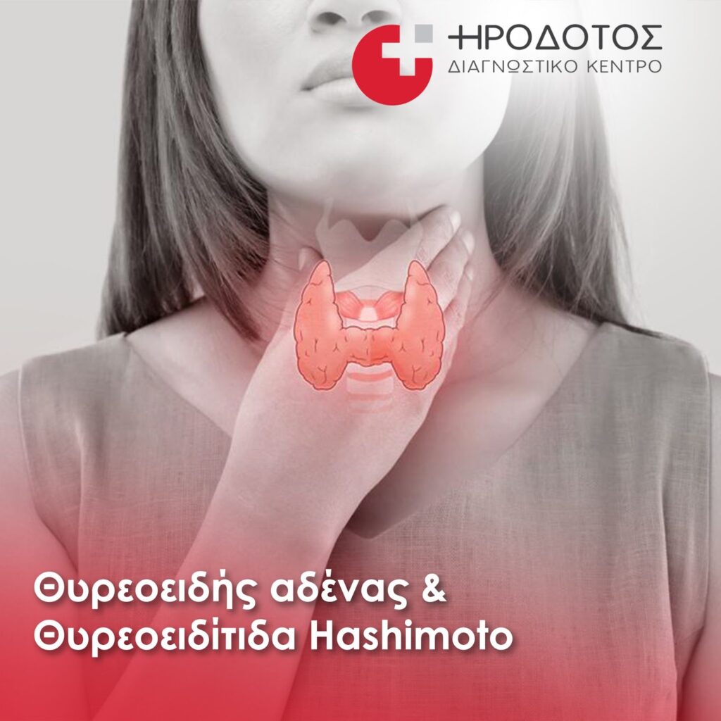 ΘΥΡΕΟΕΙΔΗΣ ΑΔΕΝΑΣ & ΘΥΡΕΟΕΙΔΙΤΙΔΑ HASHIMOTO – irodotosmed: Διαγνωστικά ...