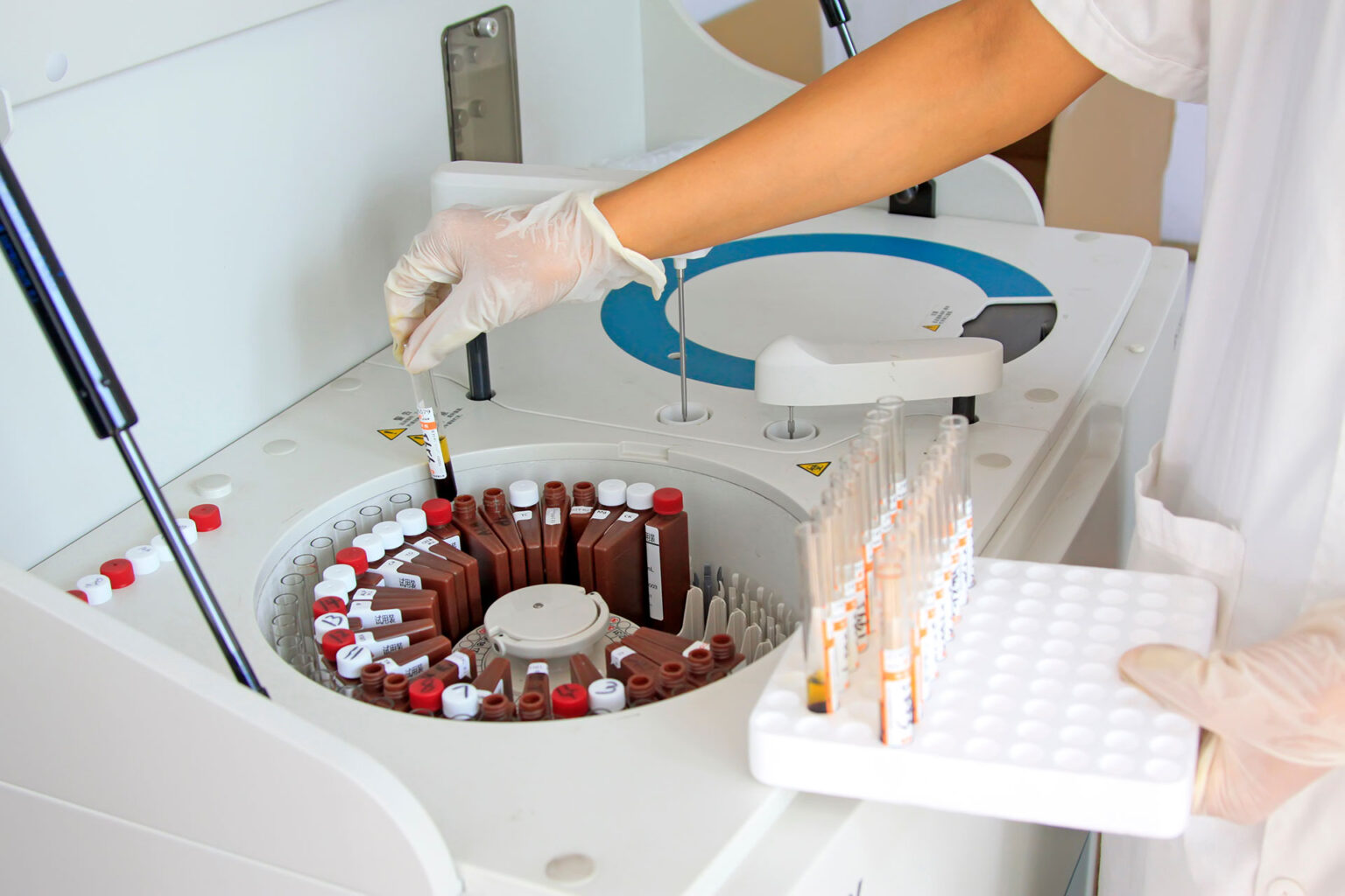 irodotosmed: Διαγνωστικά Κέντρα Ηράκλειο Κρήτης – Ακτινοδιαγνωστικό ...